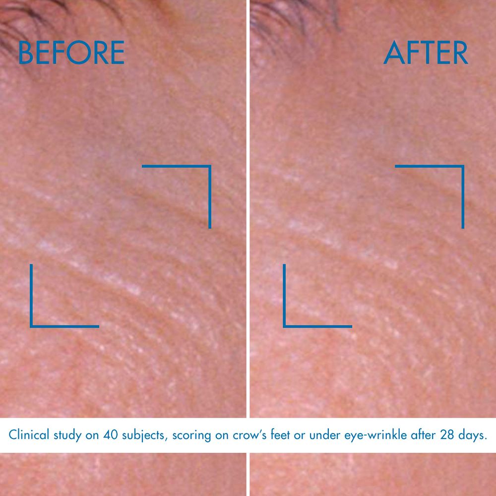 Blue Pro-Retinol Ojos: contorno de ojos con pro-retinol | Biotherm